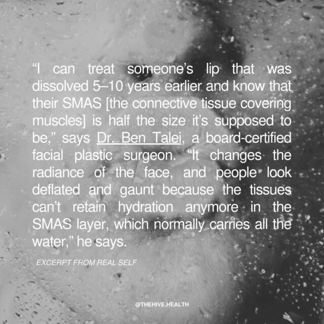 The Dark Side of Filler Dissolving: What You Should Know About ...